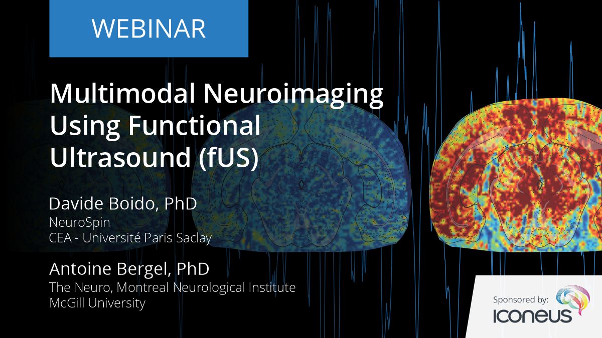 Webinar: Multimodal Neuroimaging Using Functional Ultrasound (fUS) by ...