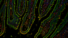 Webinar: Complex Microscopy Imaging made Simple using Mica, the world’s ...